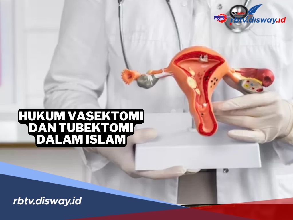 KB Permanen! Ini Hukum Vasektomi dan Tubektomi Menurut Islam